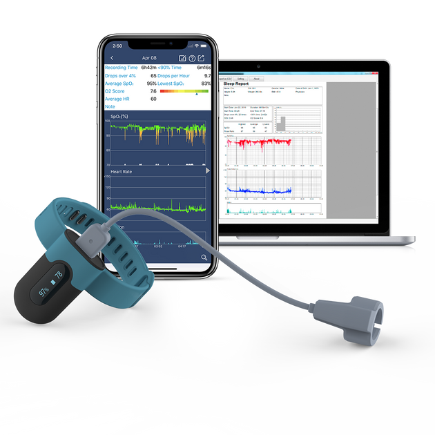 KONTINUERLIG OKSYGEN-MONITOR – NINEMI